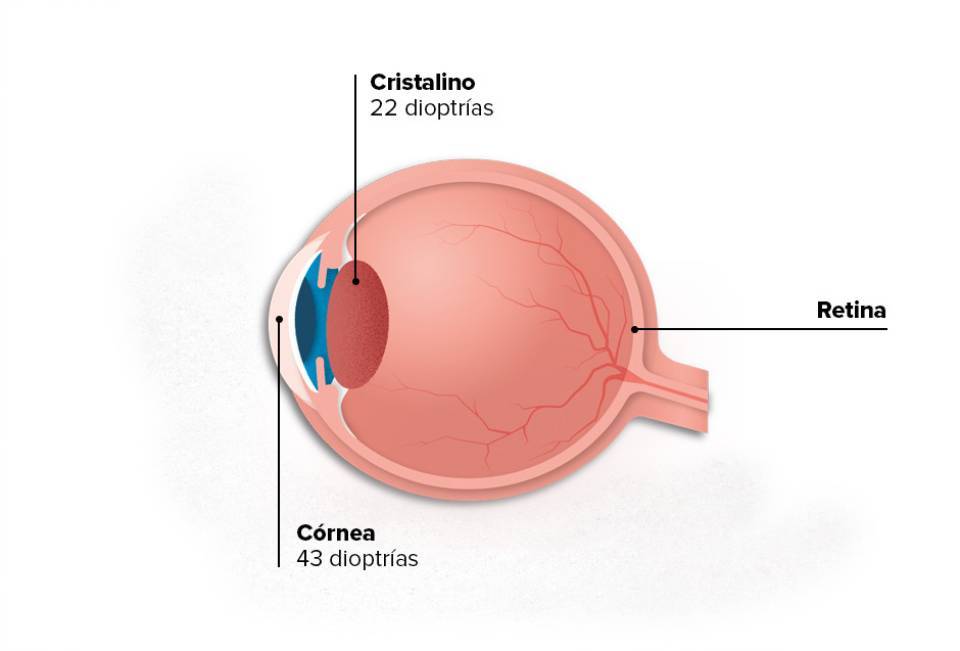 Defectos refractivos | Hospital Clínic Barcelona