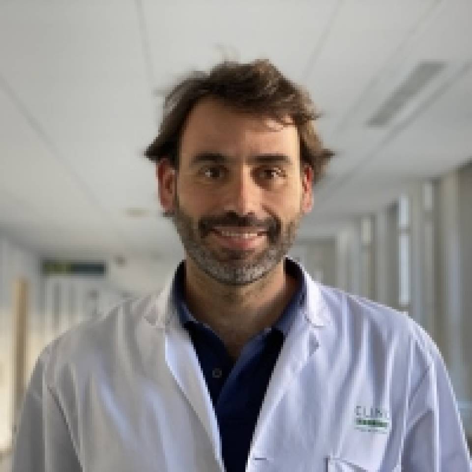 Bronchiectasis research at the Clínic | Hospital Clínic Barcelona