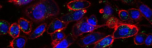 Maribel Díaz-Ricart - Hemotherapy - hemostasis| IDIBAPS