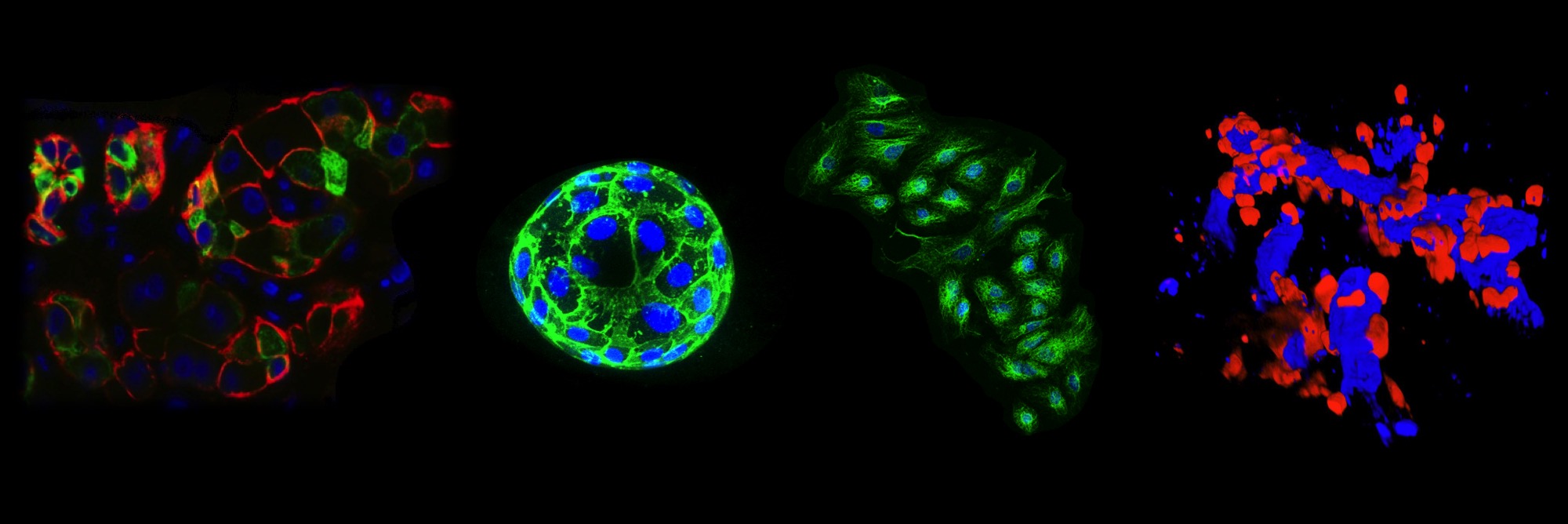 Pau Sancho Liver Cell Plasticity And Tissue Repair Idibaps