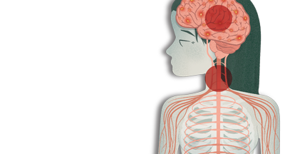 Esclerosis Múltiple | Causas, Síntomas, Tratamiento | PortalCLÍNIC