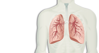 EPOC | Enfermedad Pulmonar Obstructiva Crónica | PortalCLÍNIC