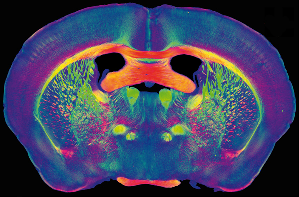 IDIBAPS participates in the ambitious Human Brain Project | Hospital ...