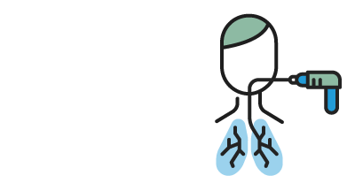 Broncoscopia | ¿Qué es la Broncoscopia? | PortalCLÍNIC