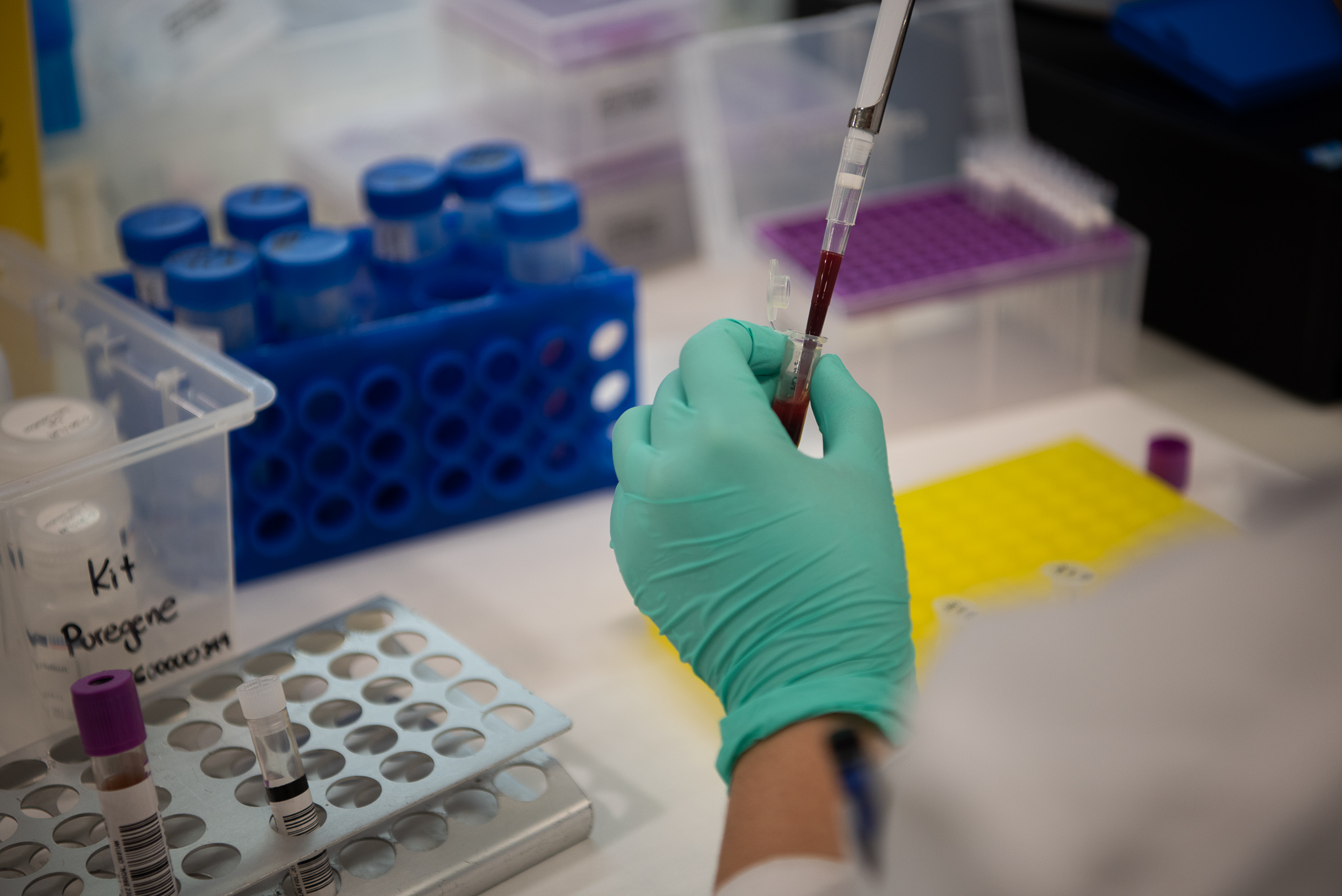 Hospital Clínic, the UB and ARTIDIS collaborate to investigate a novel ...