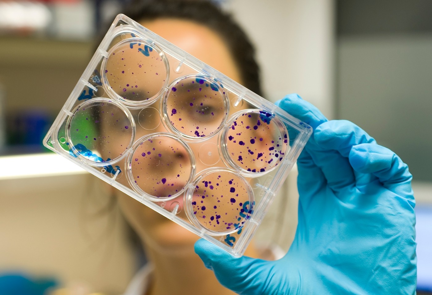 Projects and Clinical Trials | Hospital Clínic Barcelona