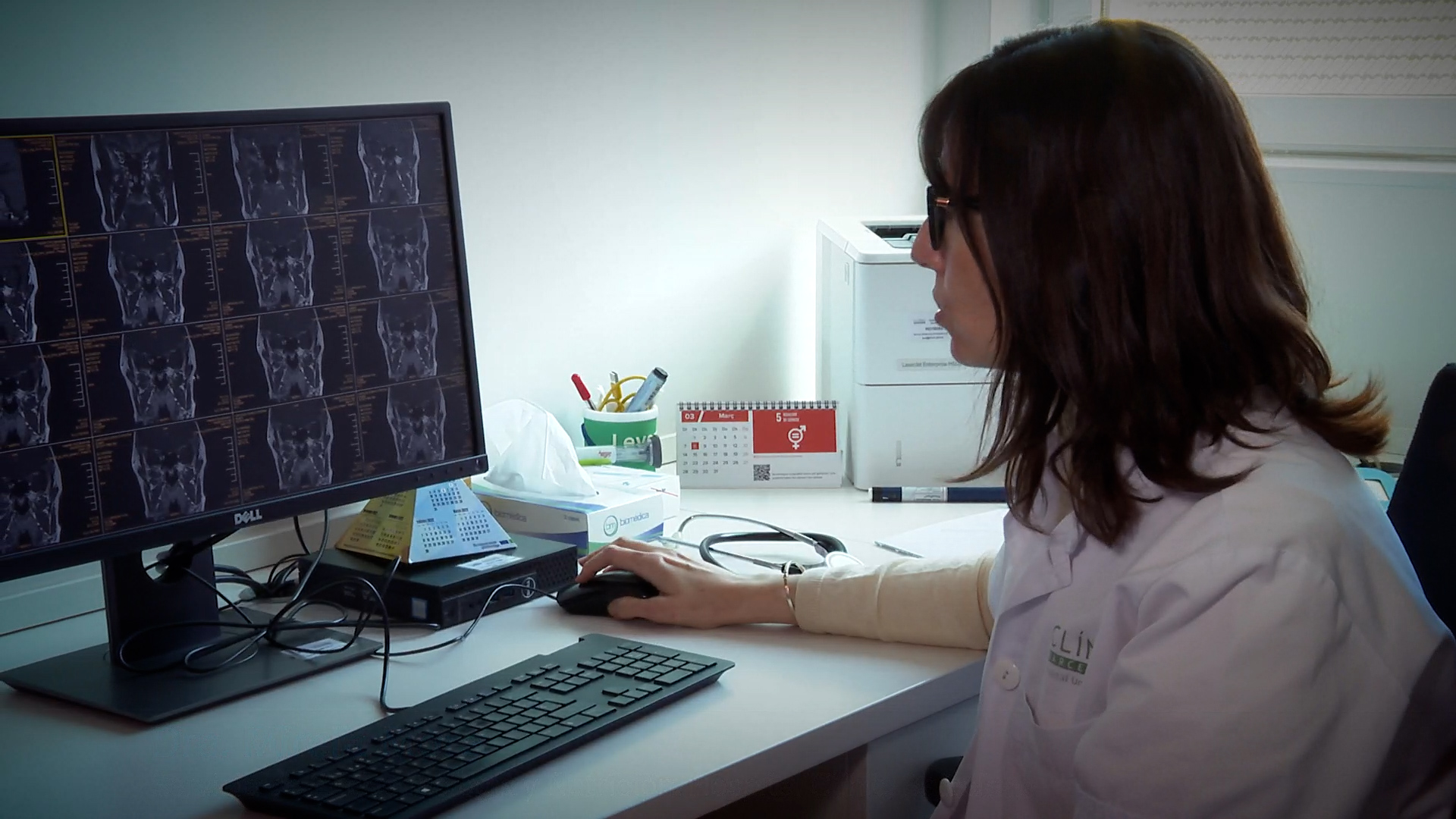 El tratamiento actual del síndrome de Cushing permite que el paciente ...