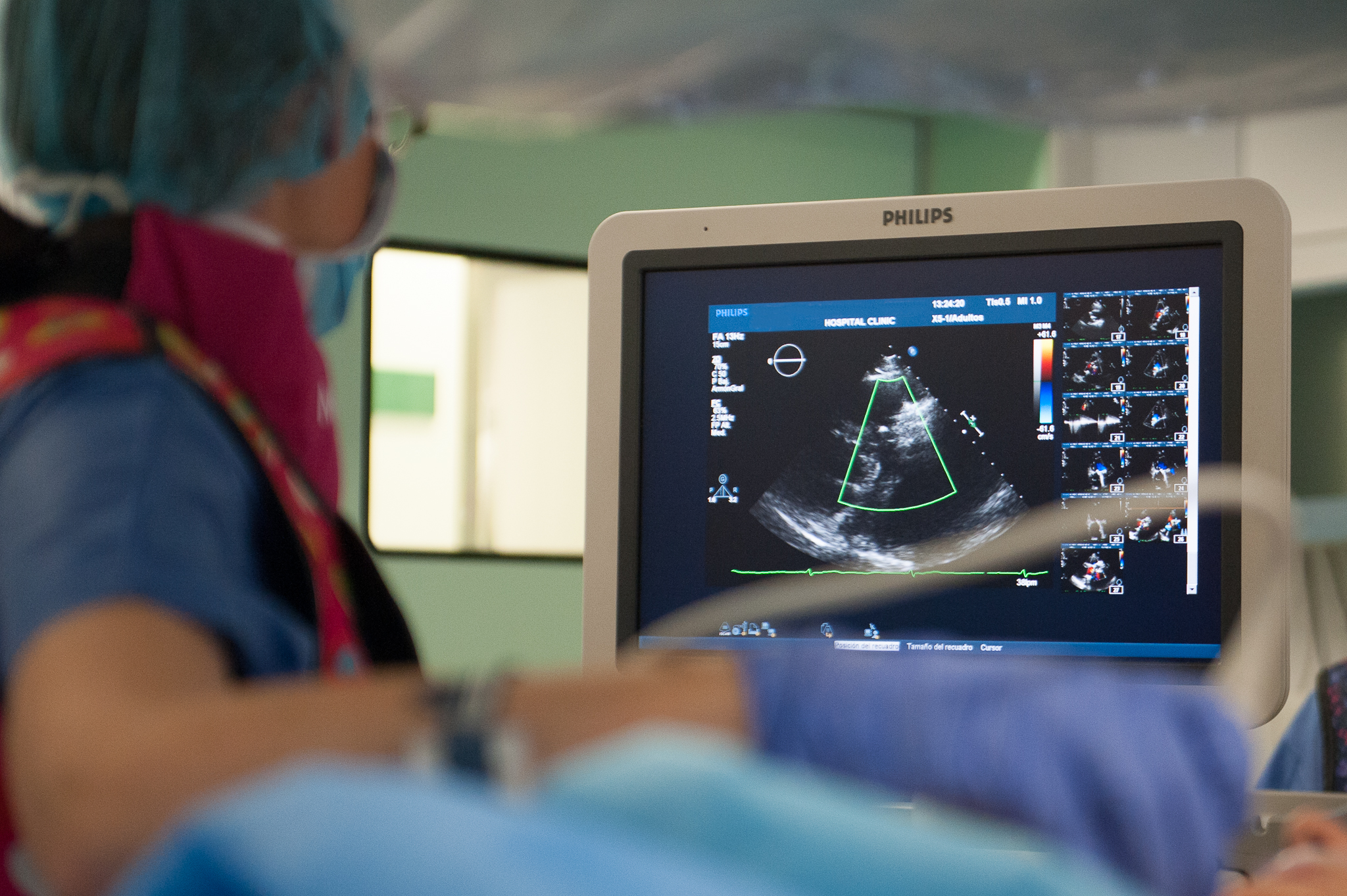 The MITMEVA project includes the first 100 patients with aortic valve ...