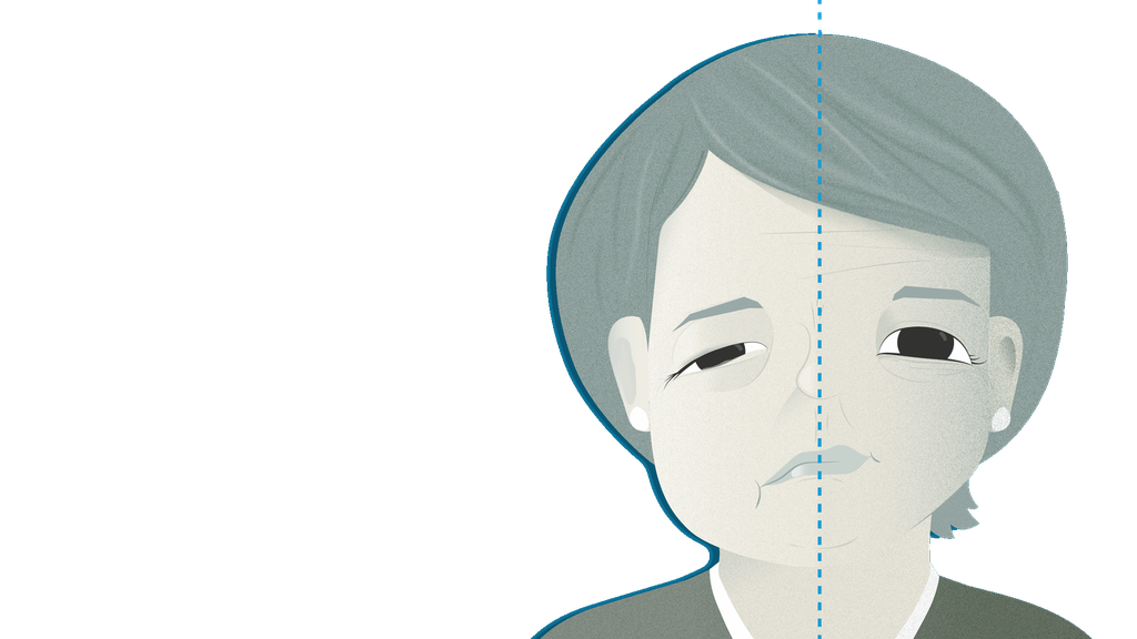 Diagnóstico de la Parálisis Facial | PortalCLÍNIC