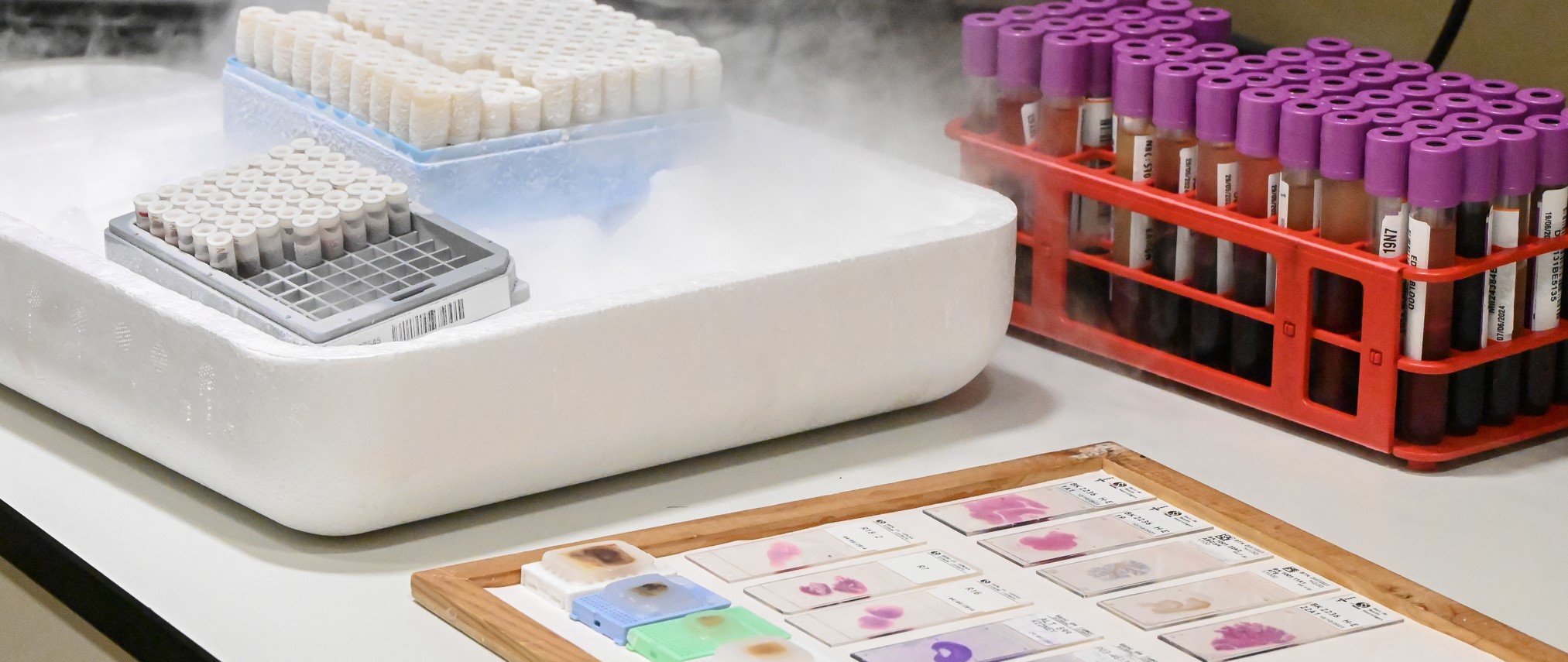 Biobank | Hospital Clínic Barcelona