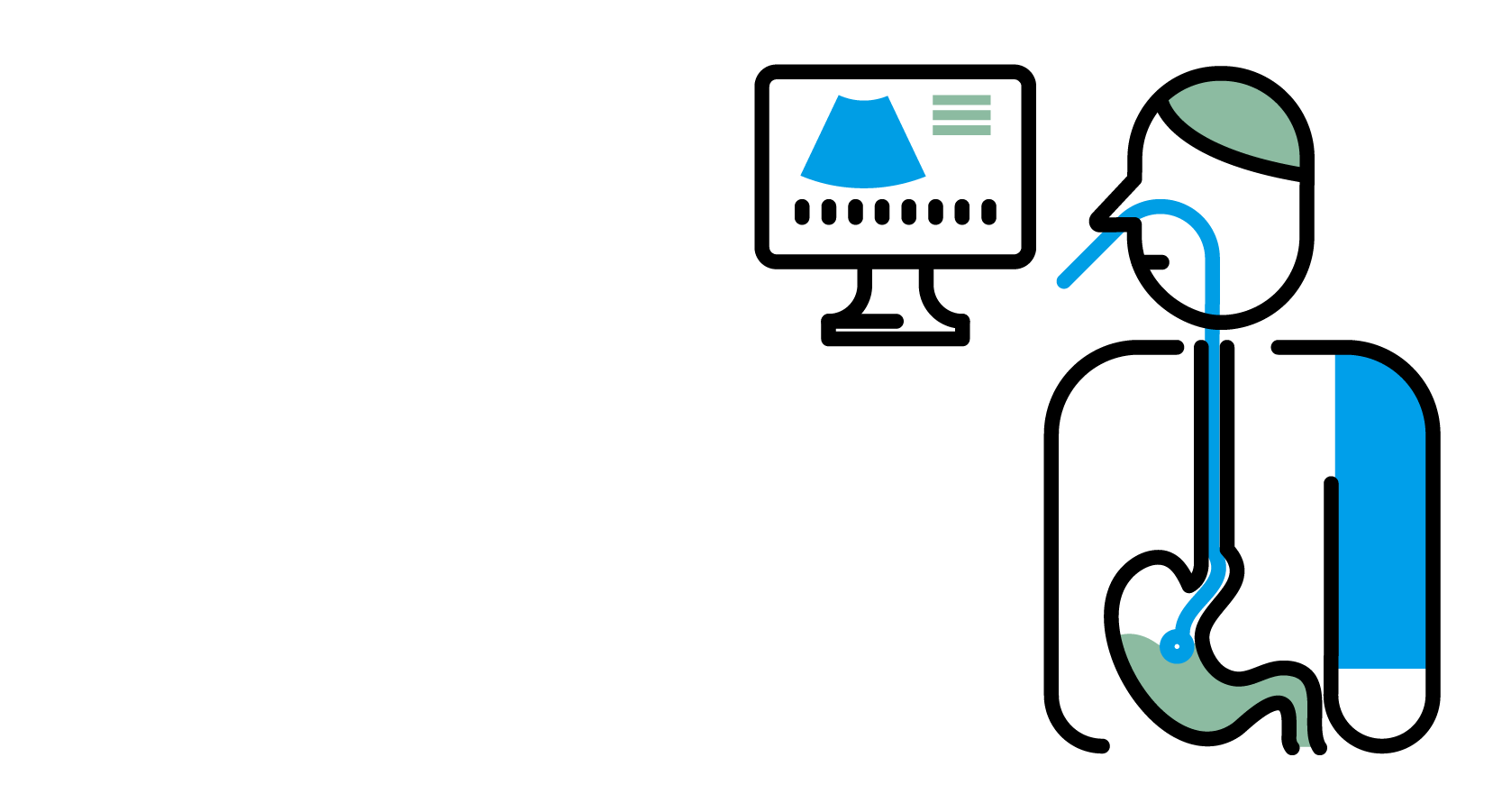 What is Oesophageal Manometry? | PortalCLÍNIC